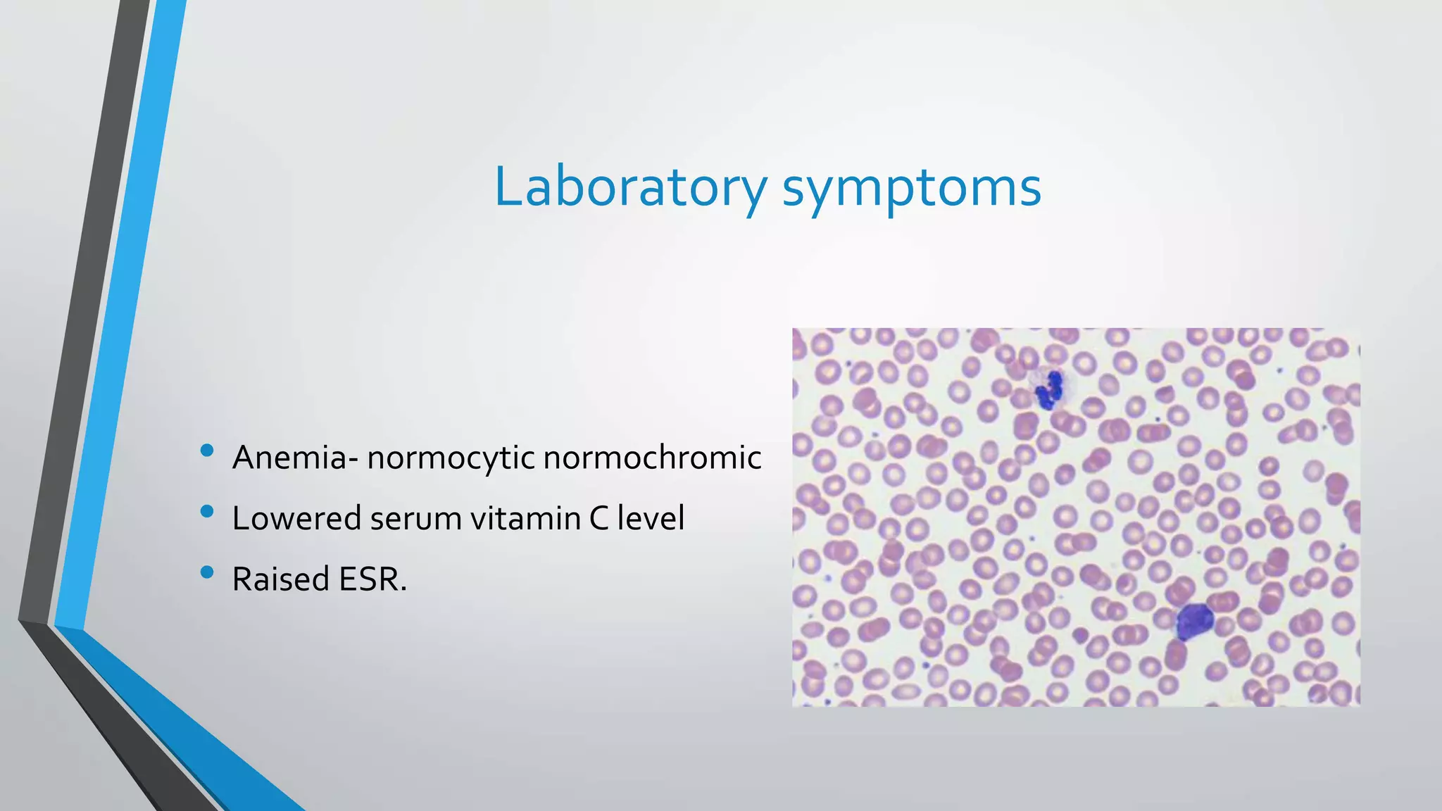 Cutaneous Manifestations of Vitamin C Deficiency | PPT