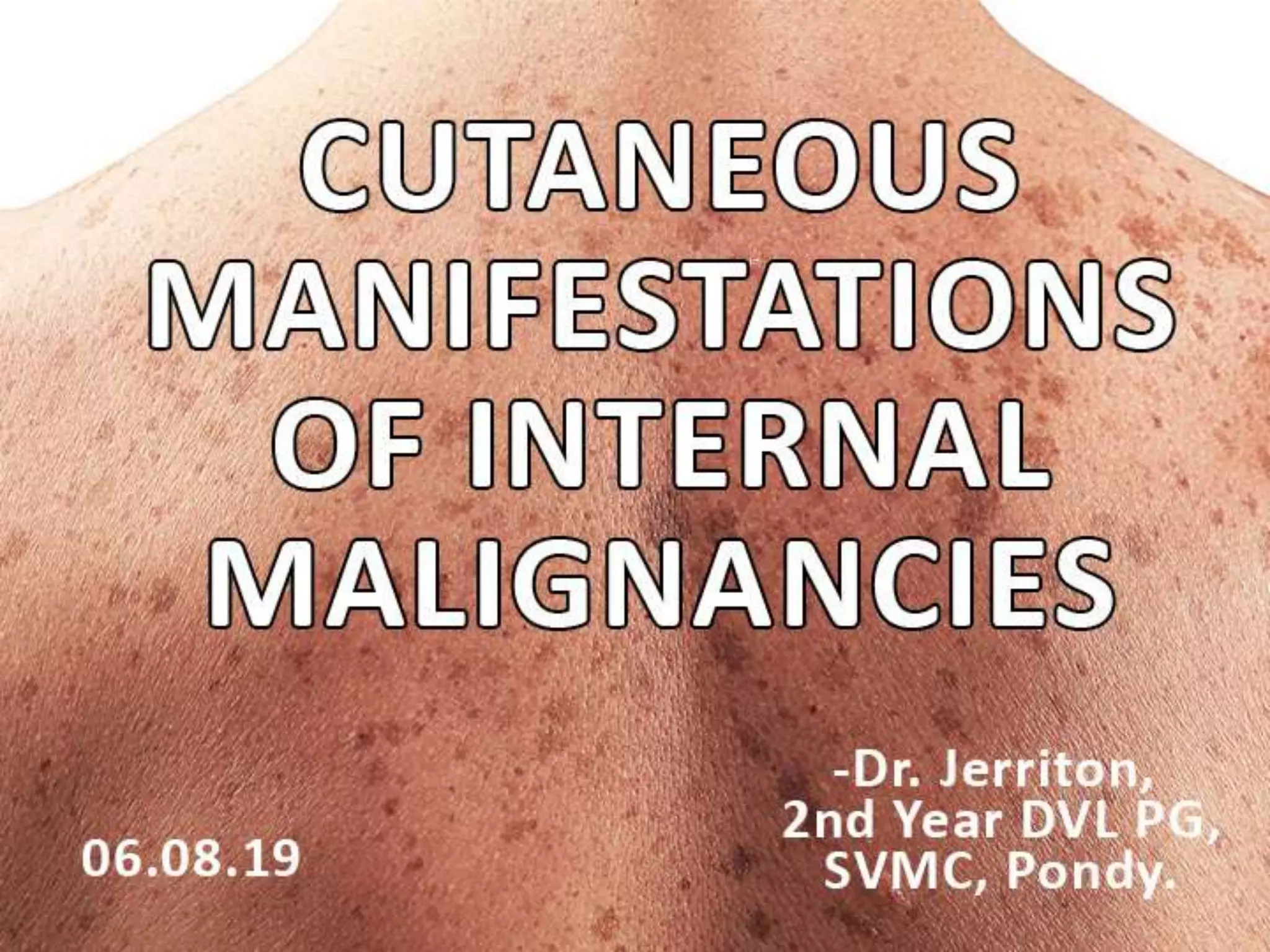 Cutaneous Manifestations of Internal Malignancies | PPTX