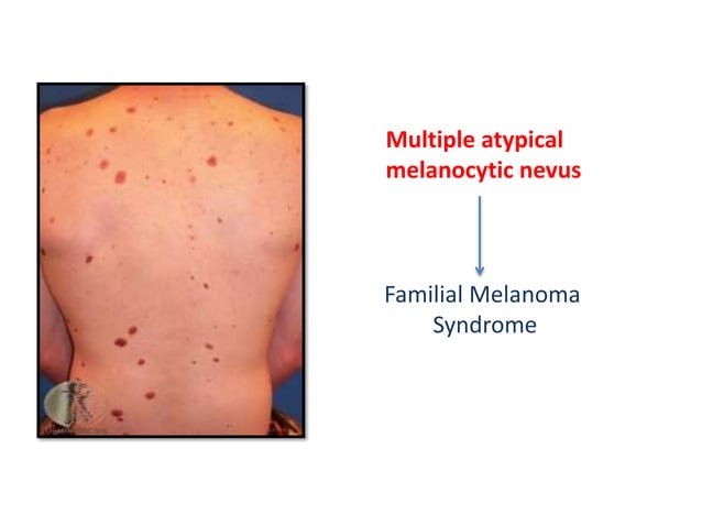 Cutaneous Manifestations of Internal Malignancies | PPTX | Skin and ...