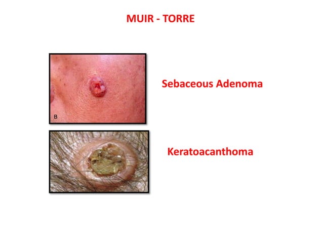 Cutaneous Manifestations of Internal Malignancies | PPTX | Skin and ...