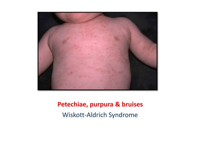 Cutaneous Manifestations of Internal Malignancies | PPTX | Skin and ...