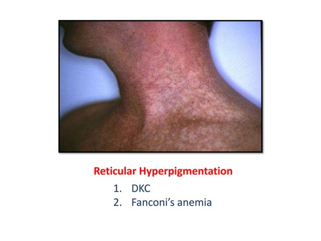 Cutaneous Manifestations of Internal Malignancies | PPTX | Skin and ...