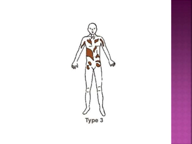 Cutaneous Mosaicisms: Concepts, Patterns, and Classifications - Dr ...
