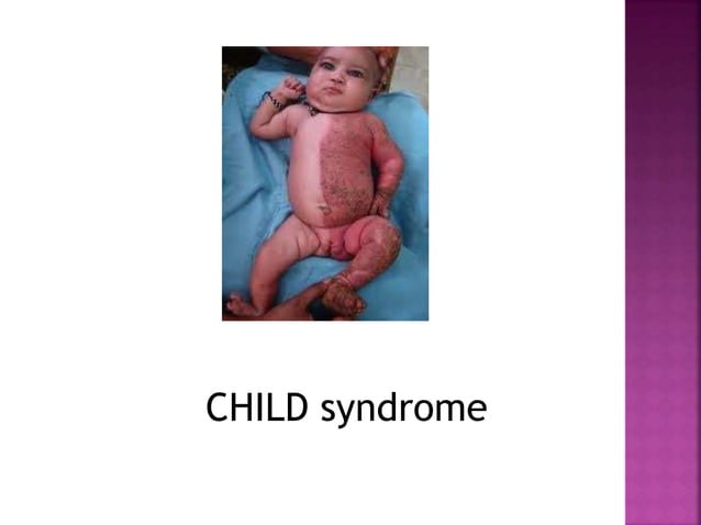 Cutaneous Mosaicisms: Concepts, Patterns, and Classifications - Dr ...