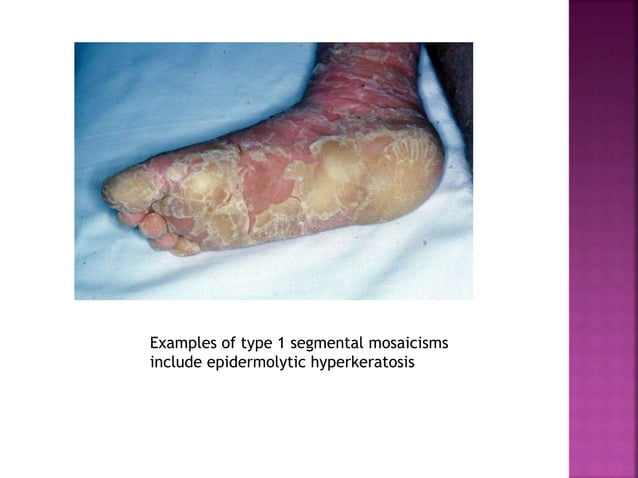 Cutaneous Mosaicisms: Concepts, Patterns, and Classifications - Dr ...