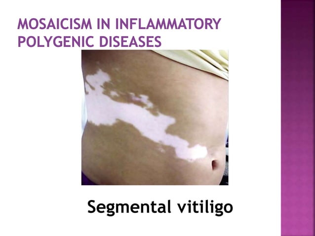 Cutaneous Mosaicisms: Concepts, Patterns, and Classifications - Dr ...