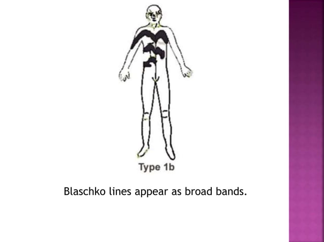 Cutaneous Mosaicisms: Concepts, Patterns, and Classifications - Dr ...