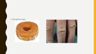 Cutaneous mucinosis | PPTX