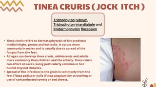 CUTANEOUS MYCOSES.pdf | Foot Health | Diseases and Conditions
