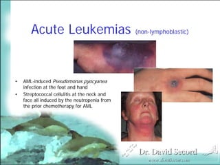 Cutaneous Presentations Of Systemic Diseases | PDF