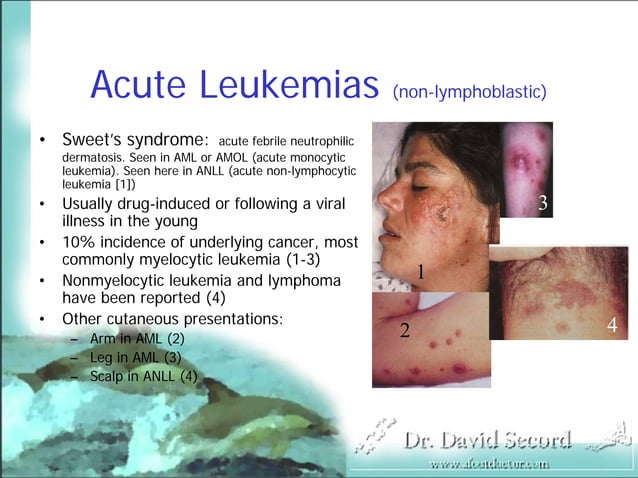 Cutaneous Presentations Of Systemic Diseases | PDF | Blood Disorders ...