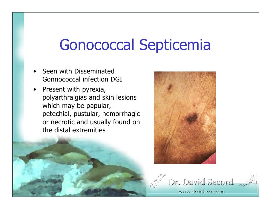 Cutaneous Presentations Of Systemic Diseases