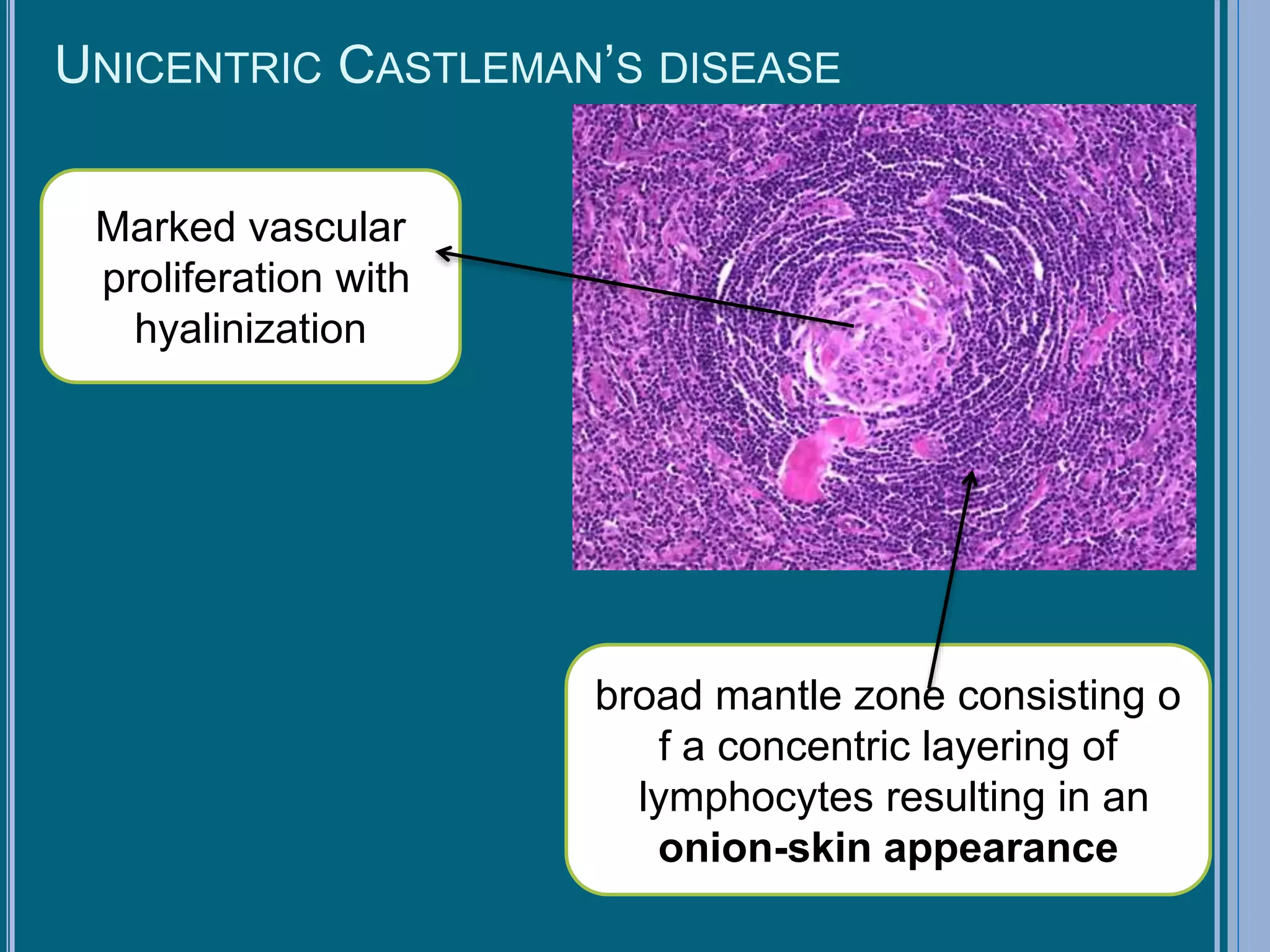Cutaneous pseudolymphoma | PPTX
