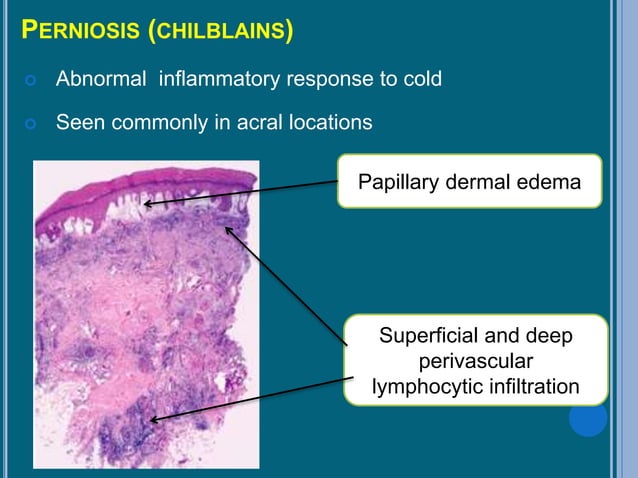 Cutaneous pseudolymphoma | PPTX