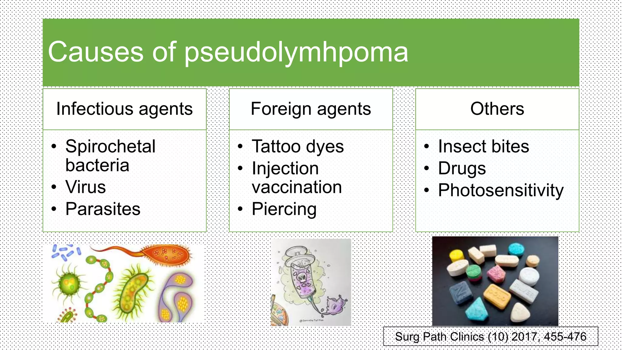 Cutaneous pseudolymphoma | PPTX