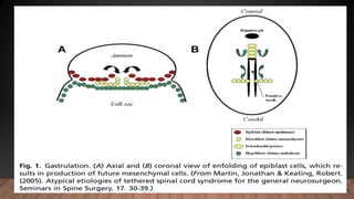 Cutaneous stigmata of spine dr jason | PPT