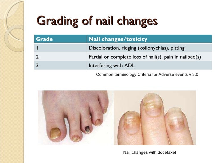 Cutaneous Toxicities Of Cancer Therapy