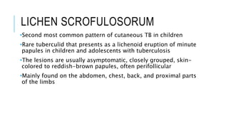Cutaneous tuberculosis | PPTX