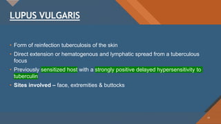 CUTANEOUS TUBERCULOSIS - Corrected 2.pdf