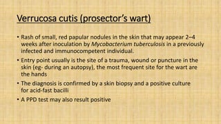 Cutaneous tuberculosis | PPTX