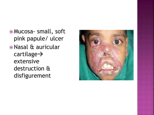 Cutaneous tuberculosis final ppt | PPTX