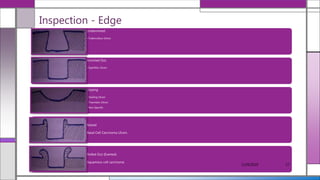 Cutaneous ulcers | PPTX