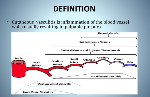 Cutaneous vasculitis by dr maria | PPTX | Blood Disorders | Diseases and Conditions