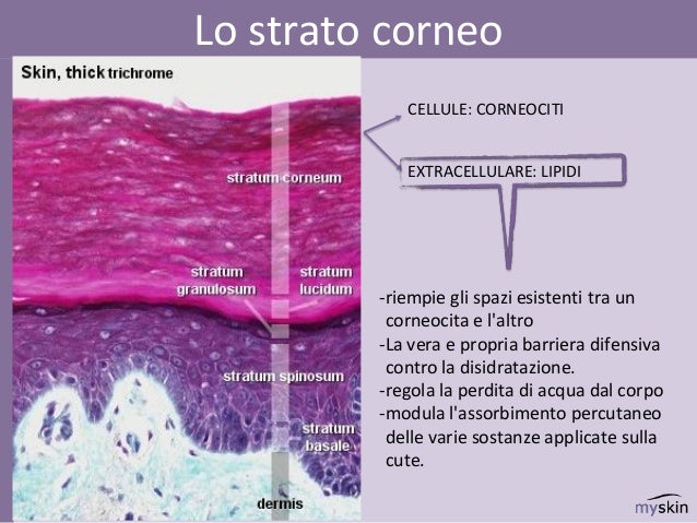 Diagramma Dello Strato Corneo