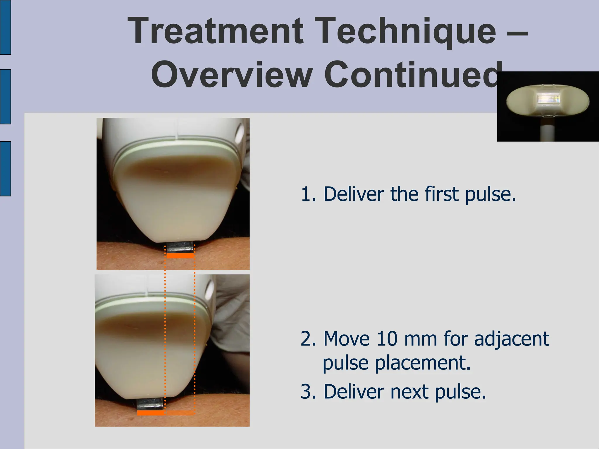cutera limelight ppt.pdf