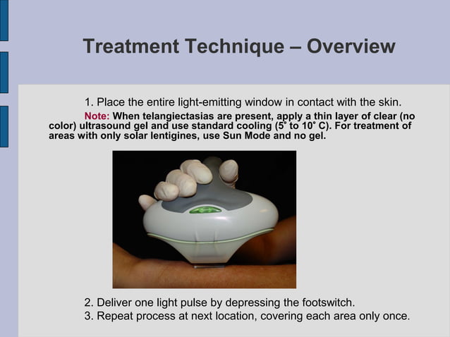cutera limelight ppt.pdf | Skin and Dermatology | Diseases and Conditions