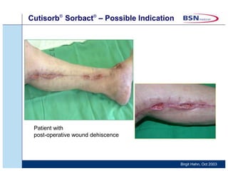 Cutisorb Sorbact.ppt