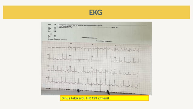 Chest unit pasien yang dirwat dirumah sakit | PPT
