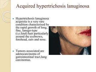 Hypertrichosis Lanuginosa Acquisita