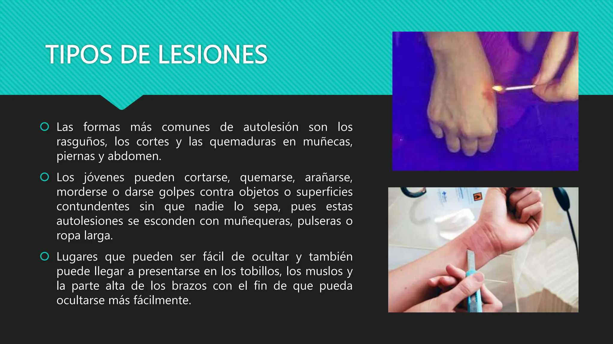 Cutting y las Autolesiones en adolescentes | PPTX
