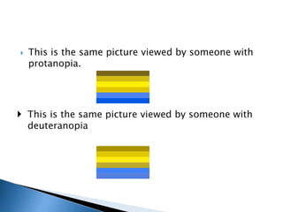 colour vision | PPTX | Eye and Vision Conditions | Diseases and Conditions