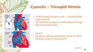 Cardiovascular disease: Acyanotic and Cyanotic Congenital Heart Defects ...