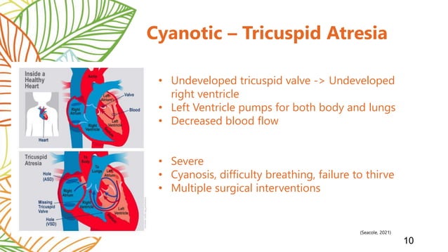 Cardiovascular disease: Acyanotic and Cyanotic Congenital Heart Defects ...