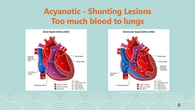 Cardiovascular disease: Acyanotic and Cyanotic Congenital Heart Defects ...