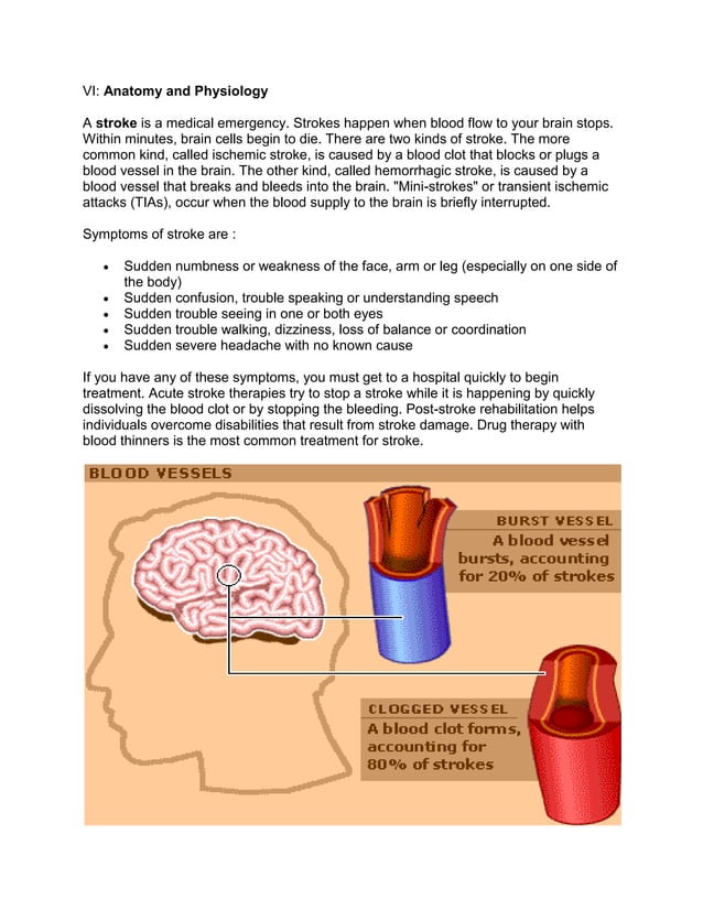 Cva | DOCX | Brain and Nervous System Disorders | Diseases and Conditions