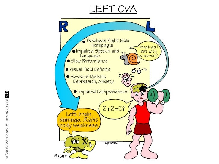 Cva Cva
