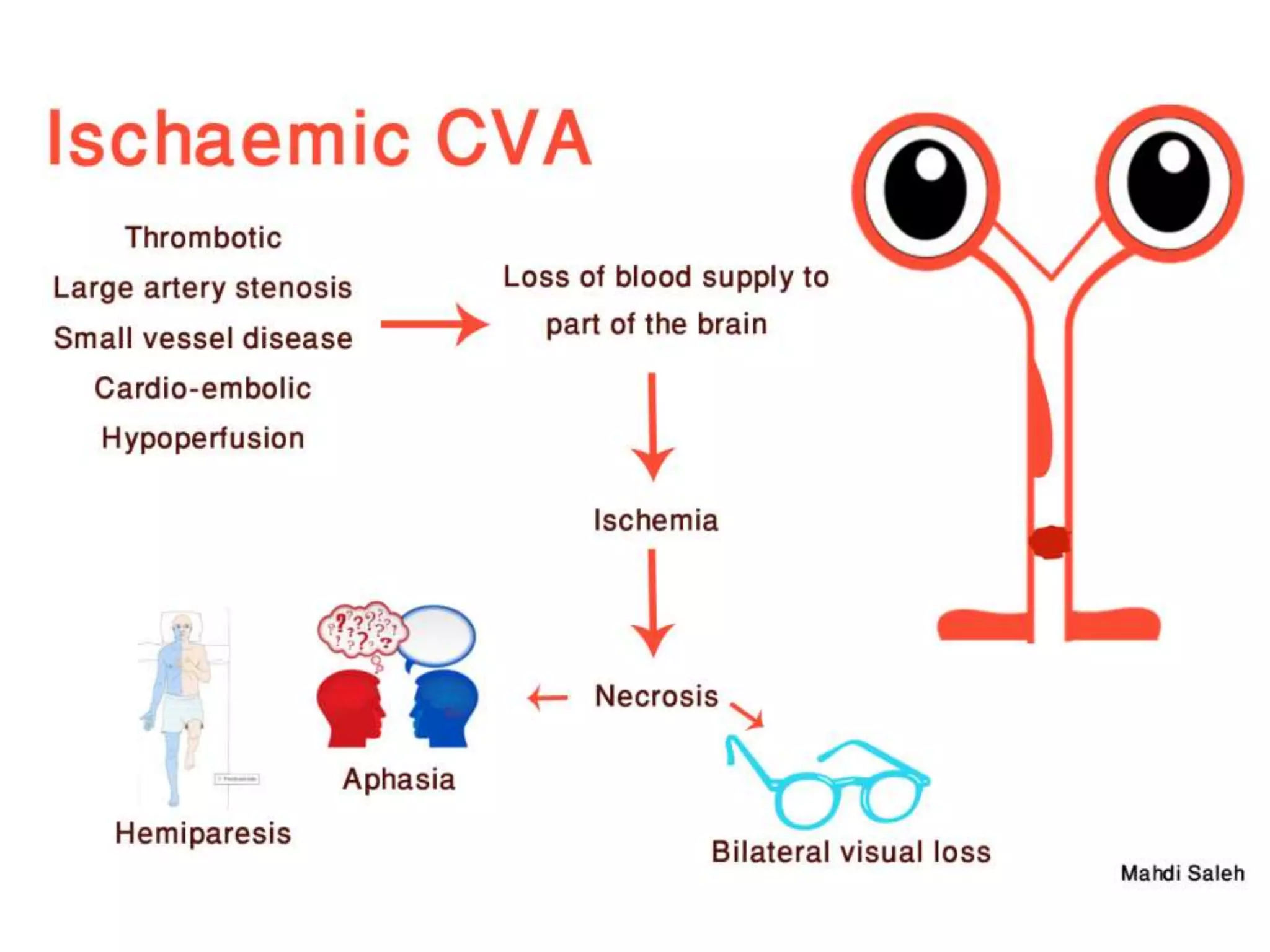 cerebrovascular accident pathophysiology | PPTX