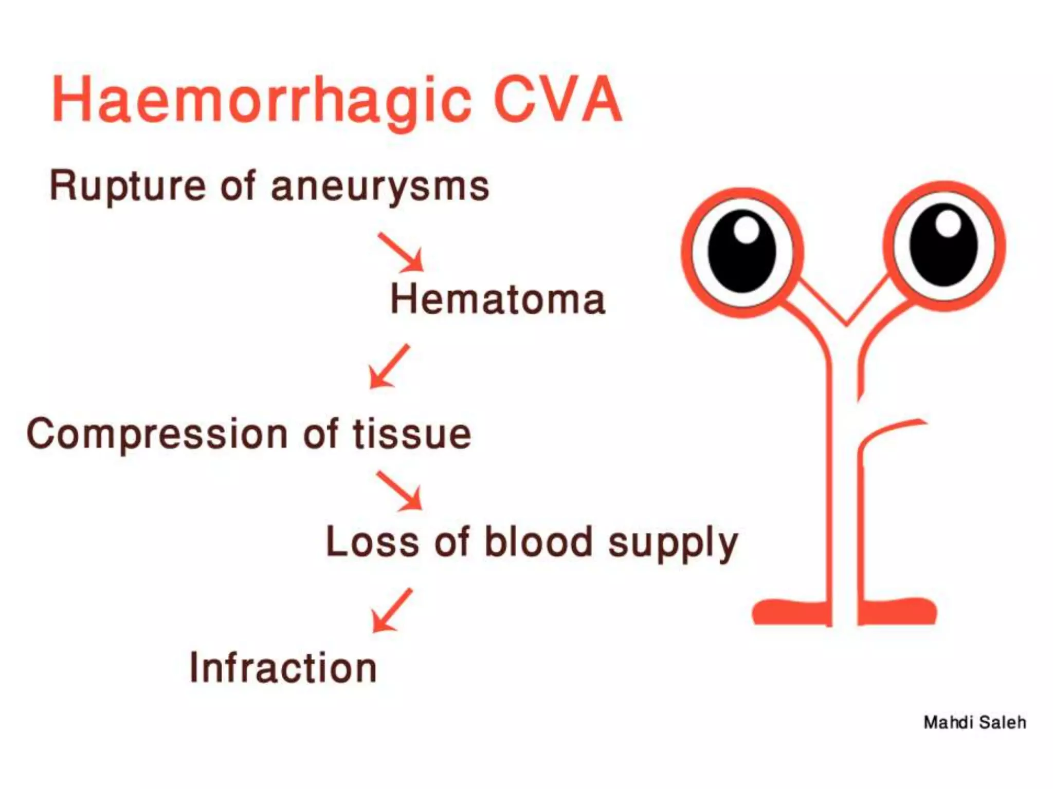 cerebrovascular accident pathophysiology | PPTX