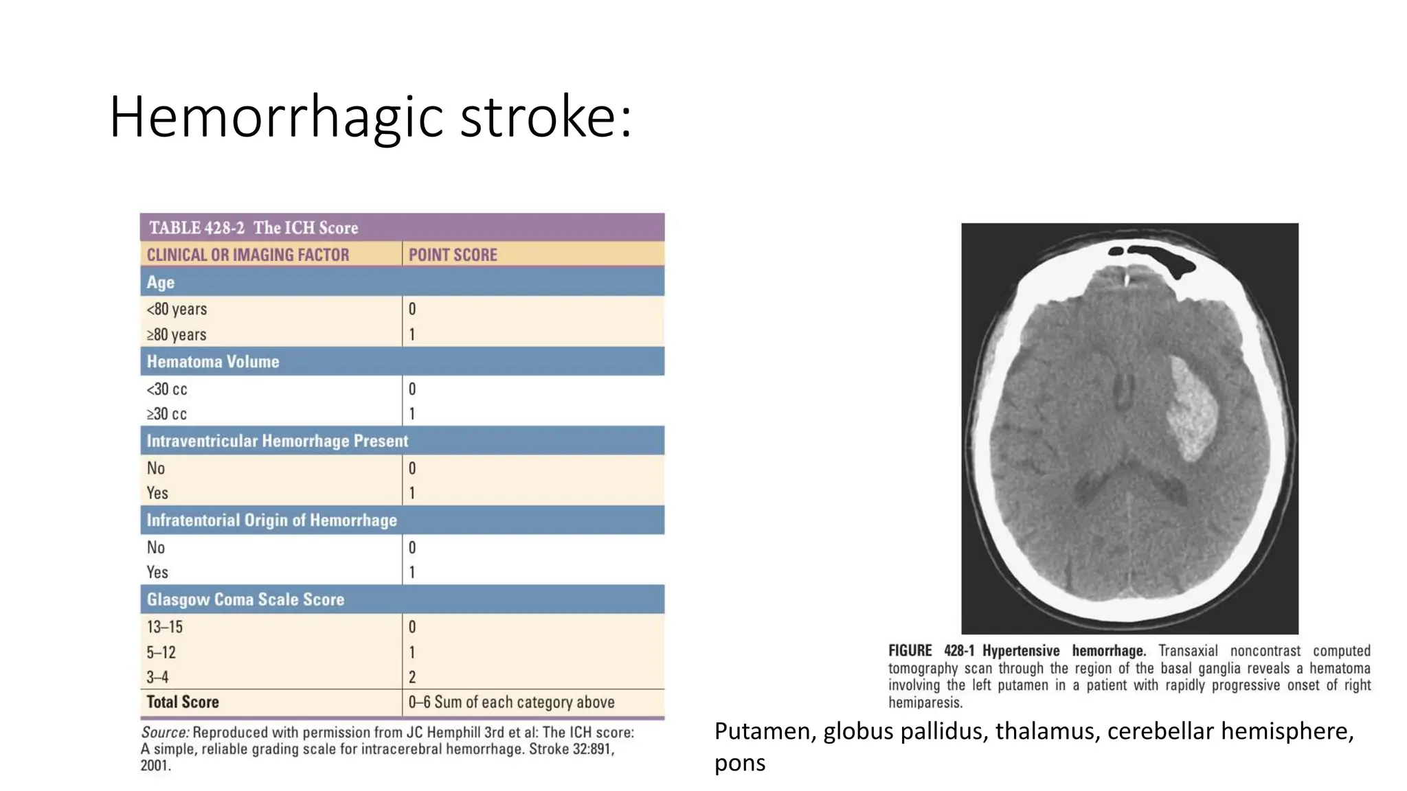 CVA.pptx stroke stroke stroke stroke stroke stroke stroke | PPTX