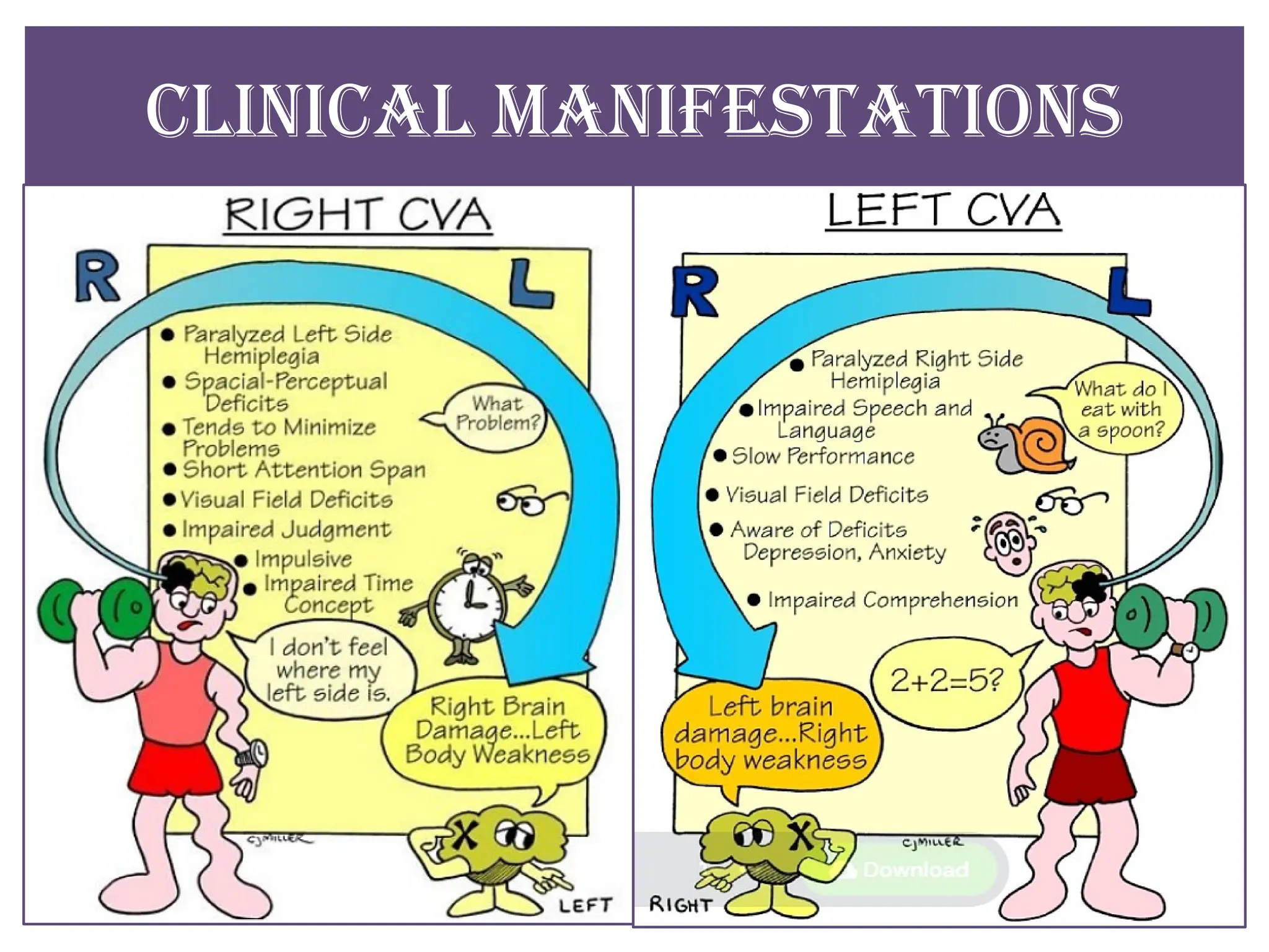 CVA - Cerebrovascular Accident / Stroke | PPTX