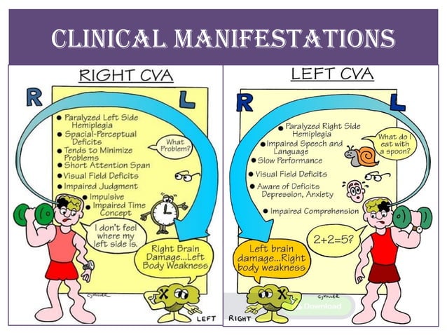 CVA - Cerebrovascular Accident / Stroke | PPTX | Blood Disorders ...