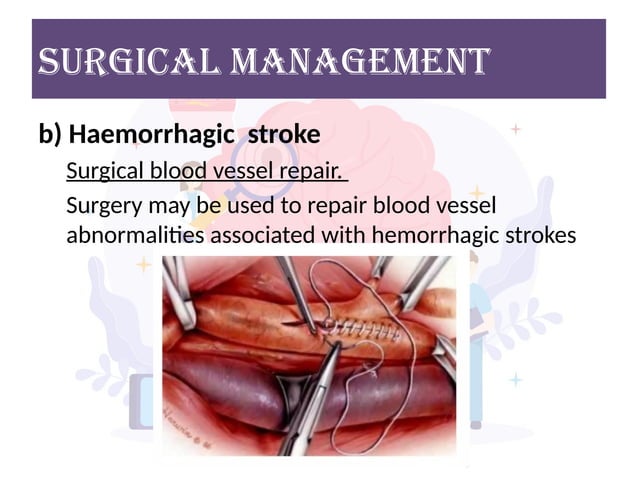 CVA - Cerebrovascular Accident / Stroke | PPTX | Blood Disorders ...
