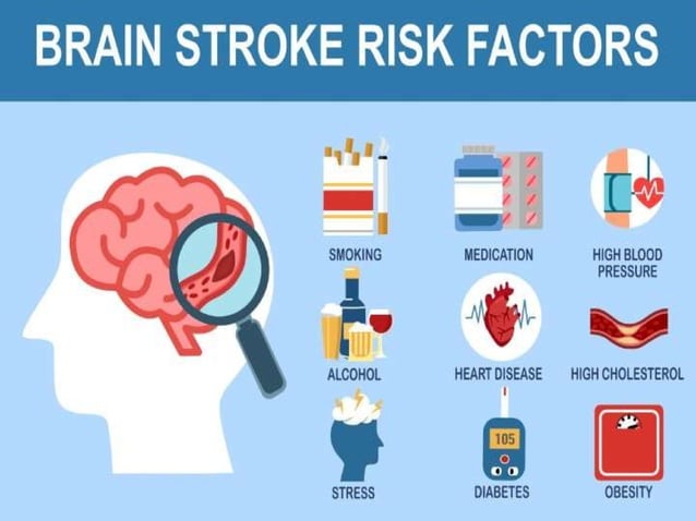 CVA - Cerebrovascular Accident / Stroke | PPTX | Blood Disorders ...