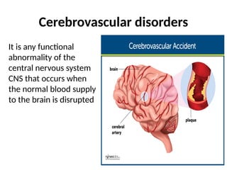 CVA. described the VCA cases and how to treat it | PPT