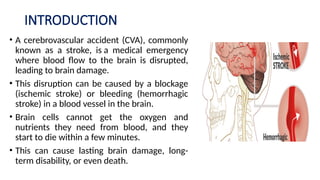 CVA.pptx cerebrovascular accident cerebrovascular accident | PPTX