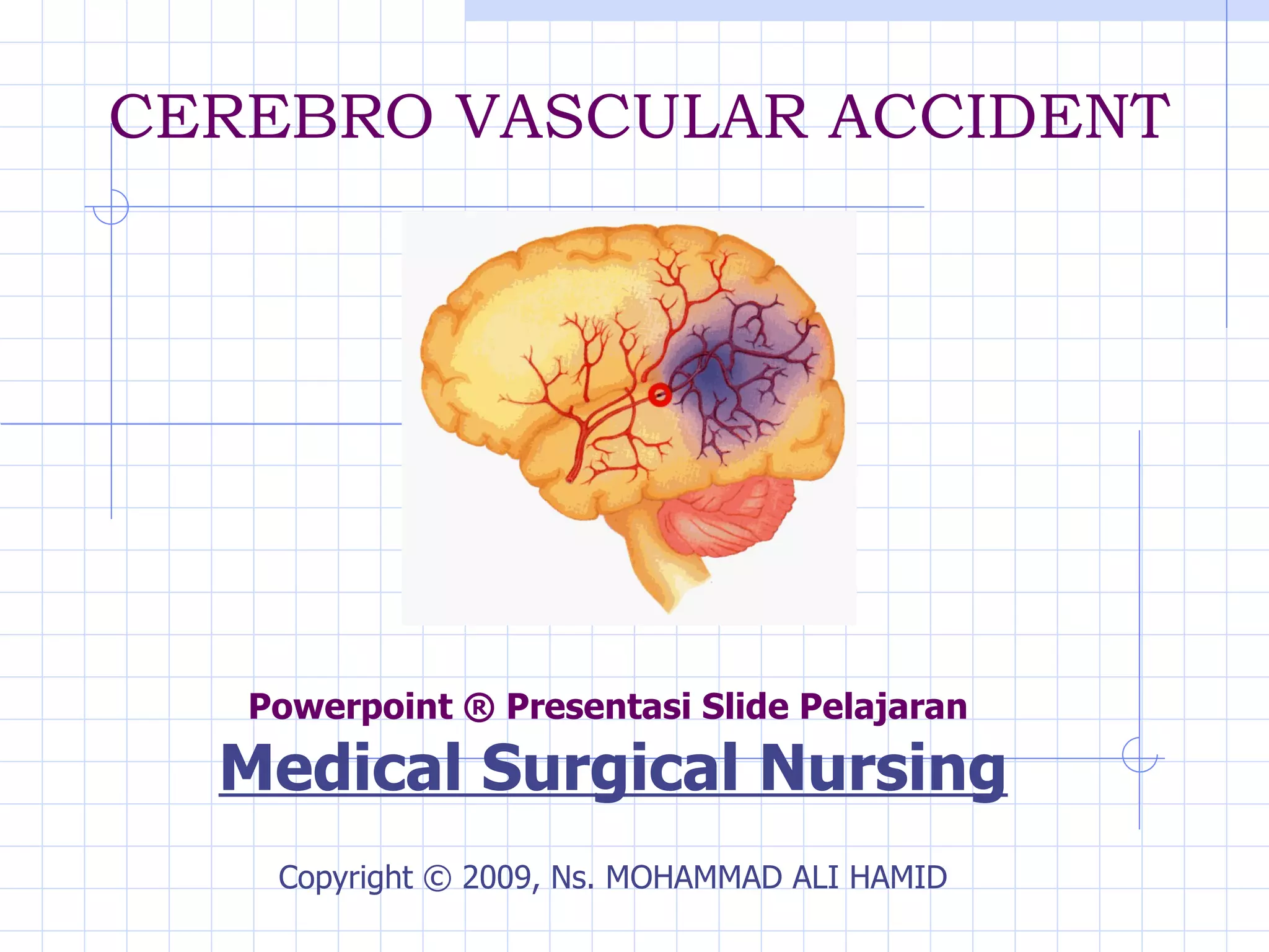 CVA | PPT